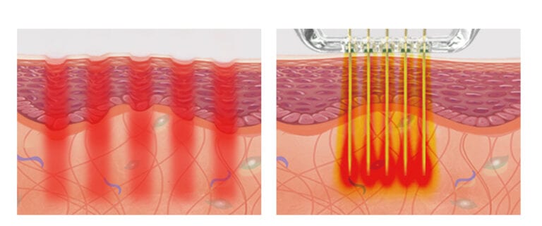 Fraxis | Vein & Skin Clinic
