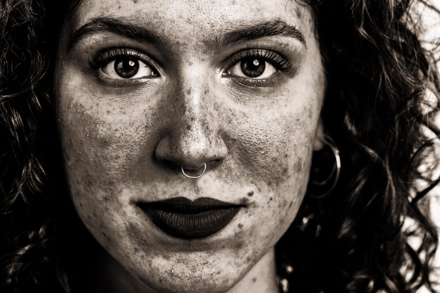Skin Cancer | Vein & Skin Clinic